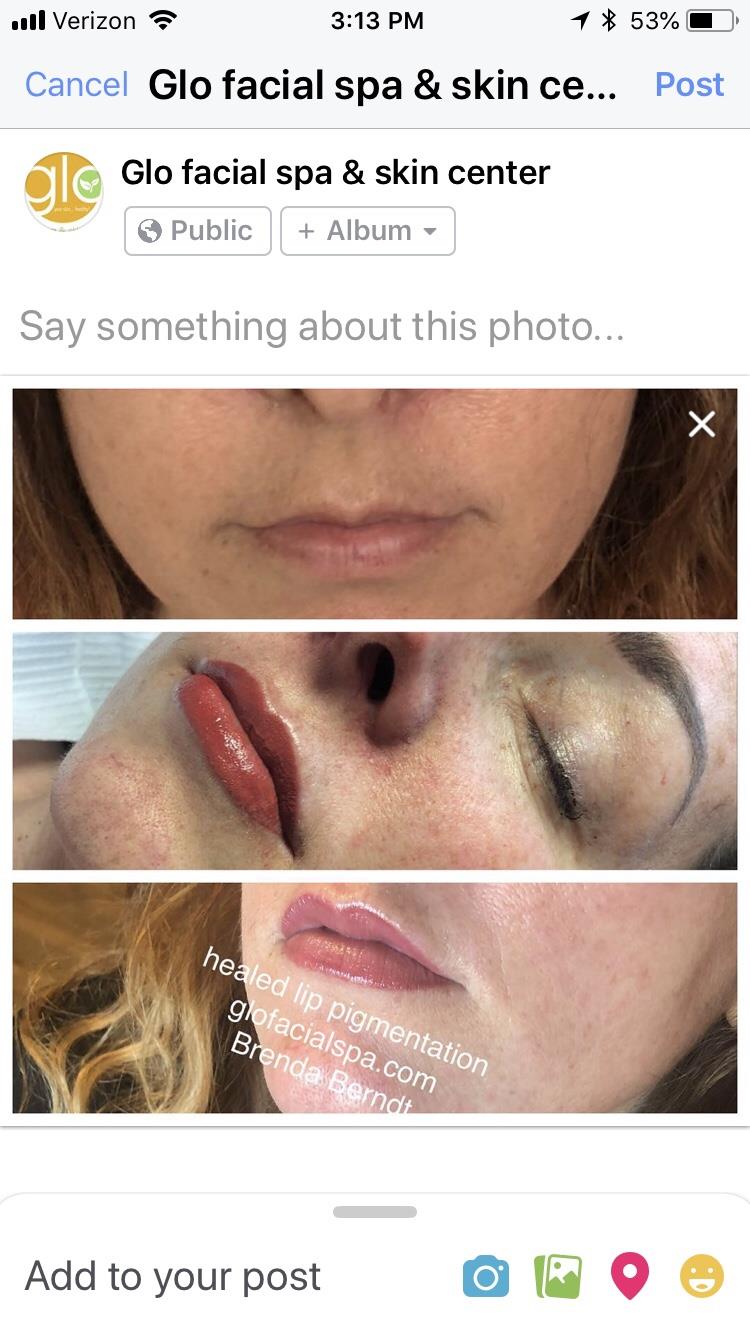 Glo Facial Spa & Skin Center In Normal IL | Vagaro